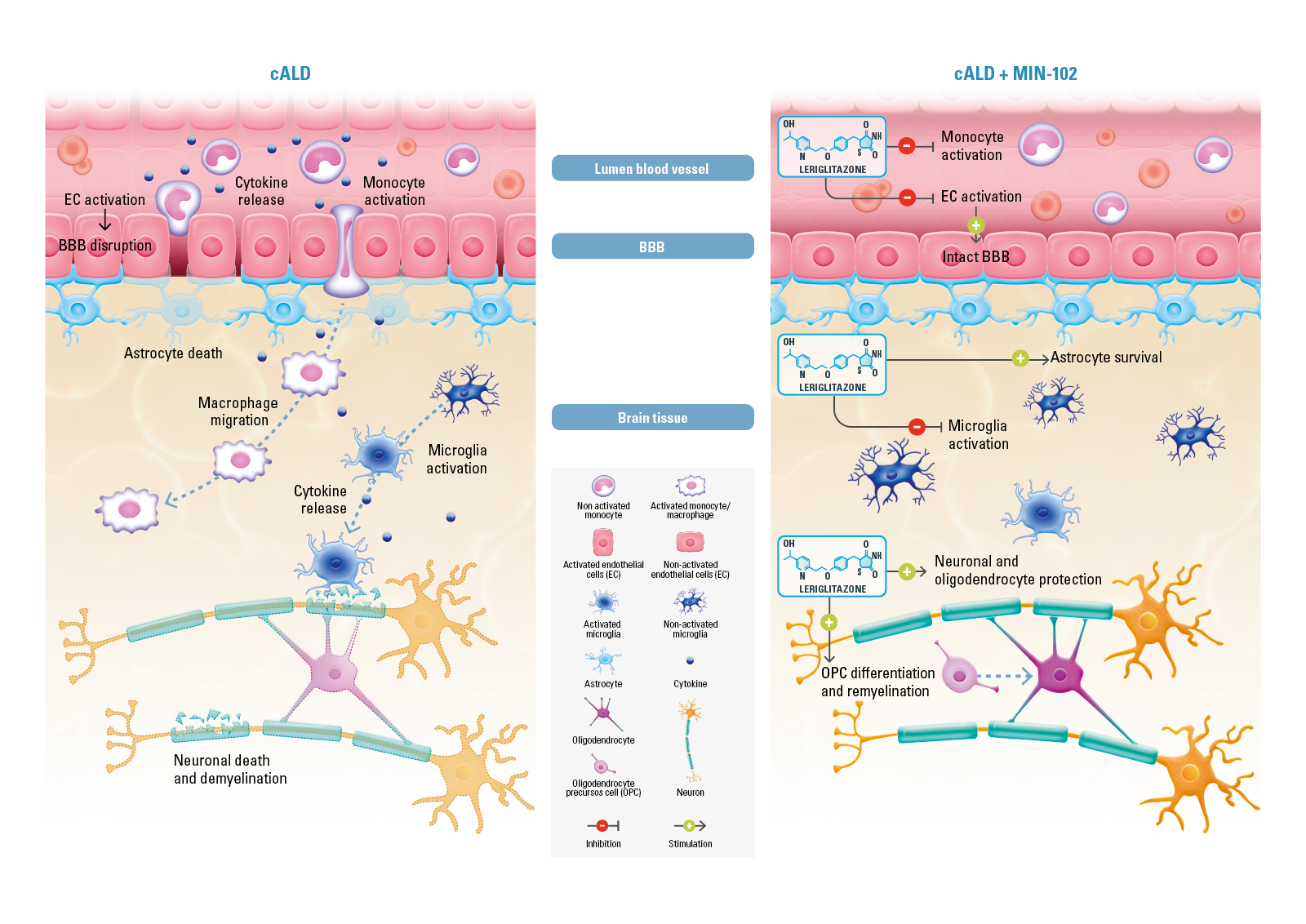 Minoryx Leriglitazone